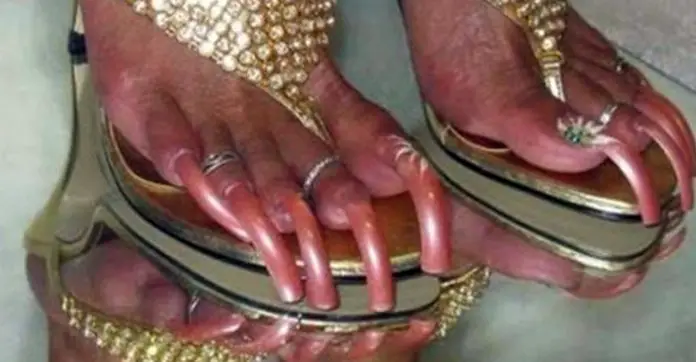 10 Extremely Long Toenails You Have To See In Order To Believe - Page 2 ...