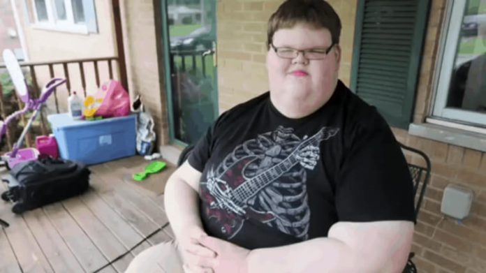At 715 Pounds Jacob Miller Was The Heaviest Teen In The World