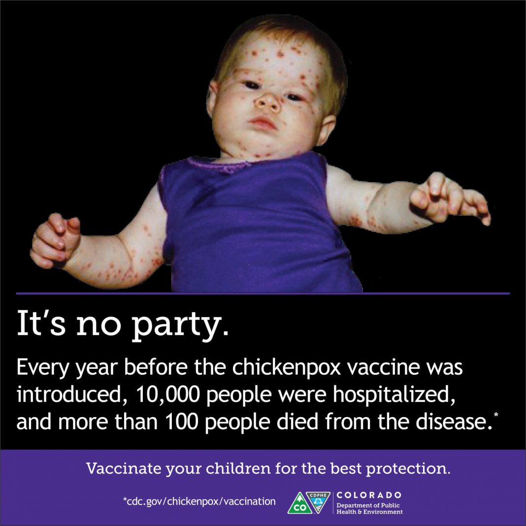 Doctors Are Warning Parents To Avoid Trendy Chickenpox Parties