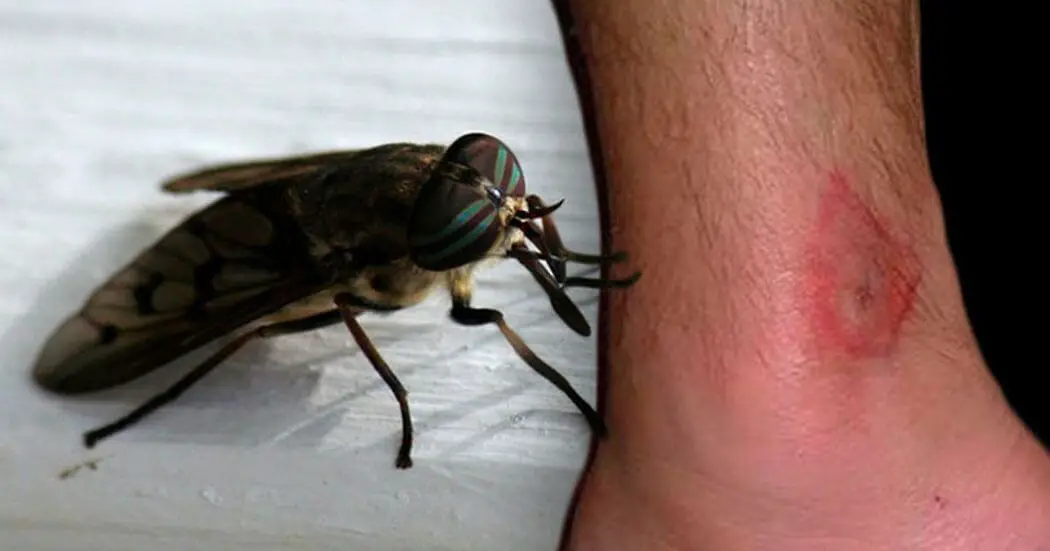 12 Common Bug Bites And How To Recognize Each One